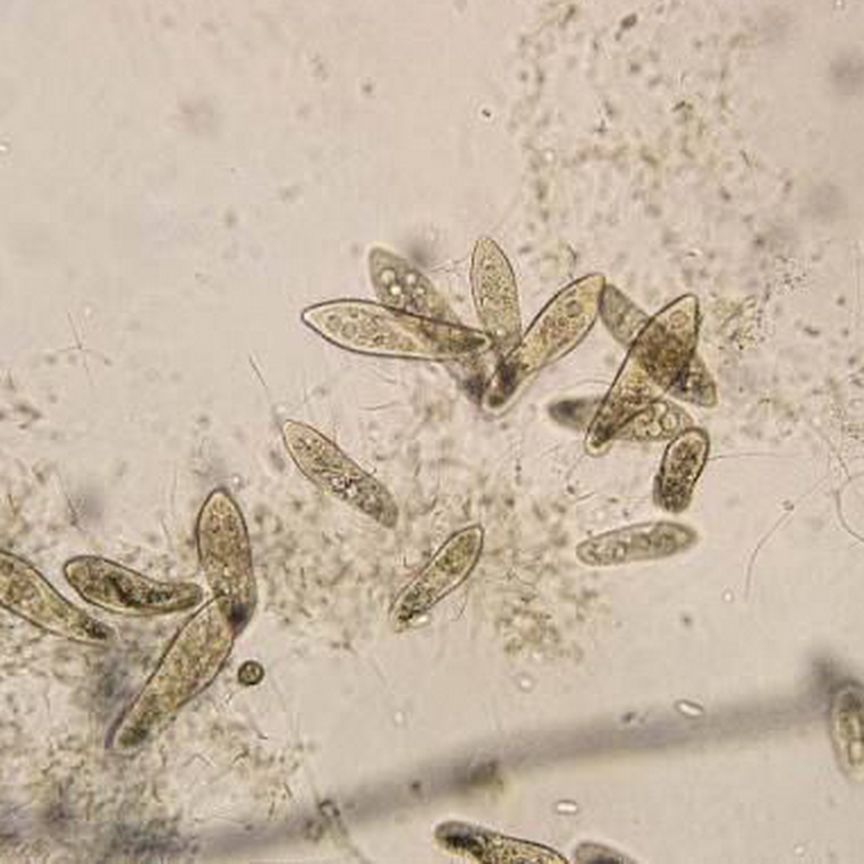 Инфузория туфелька